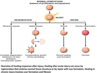 Healing and repair | PPT