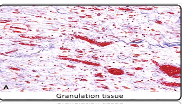 Healing and repair | PPTX | Injuries | Diseases and Conditions