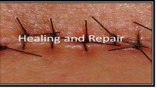 Healing and repair | PPTX