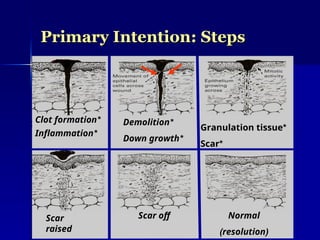 Healing_and_Repair presentation lecture.ppt