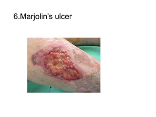 Healing and repair specialized tissue- 3 | PPT
