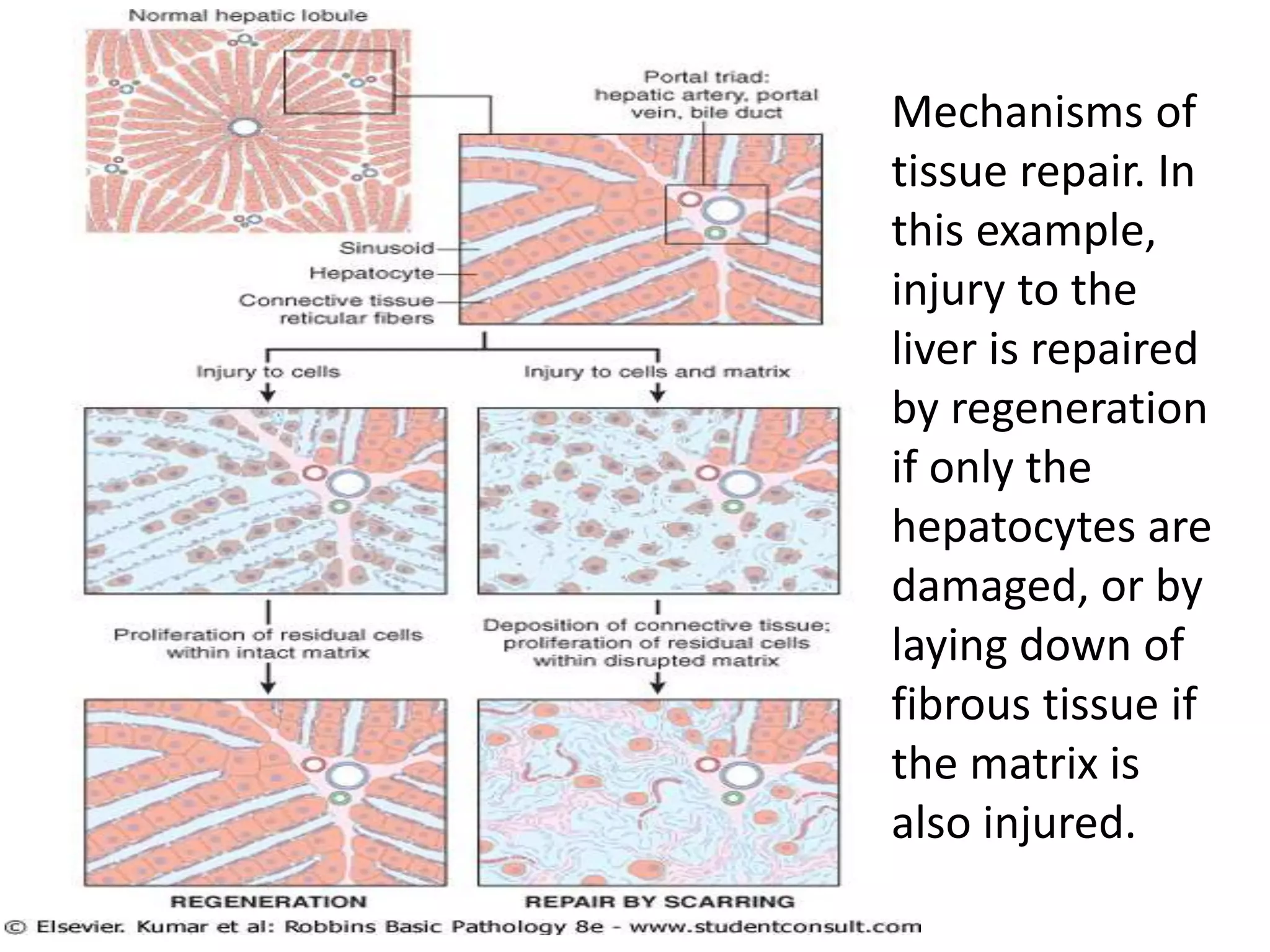 healing and repair omer altahir.pptx