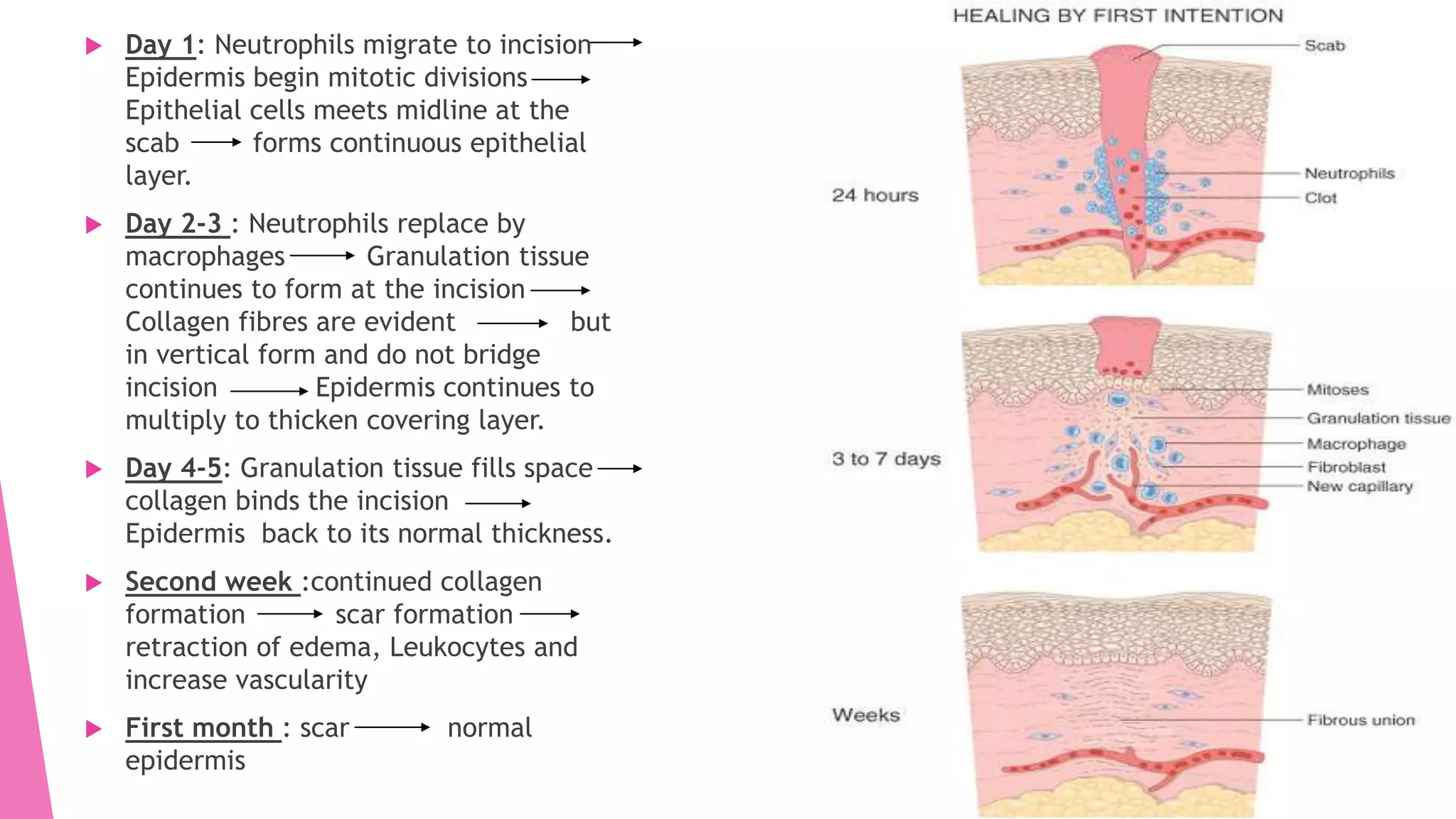 Healing and wound contraction in inflammation | PPTX