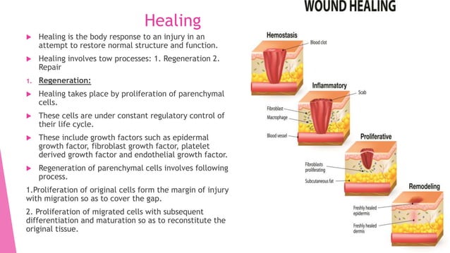 Healing and wound contraction in inflammation | PPTX | Injuries ...