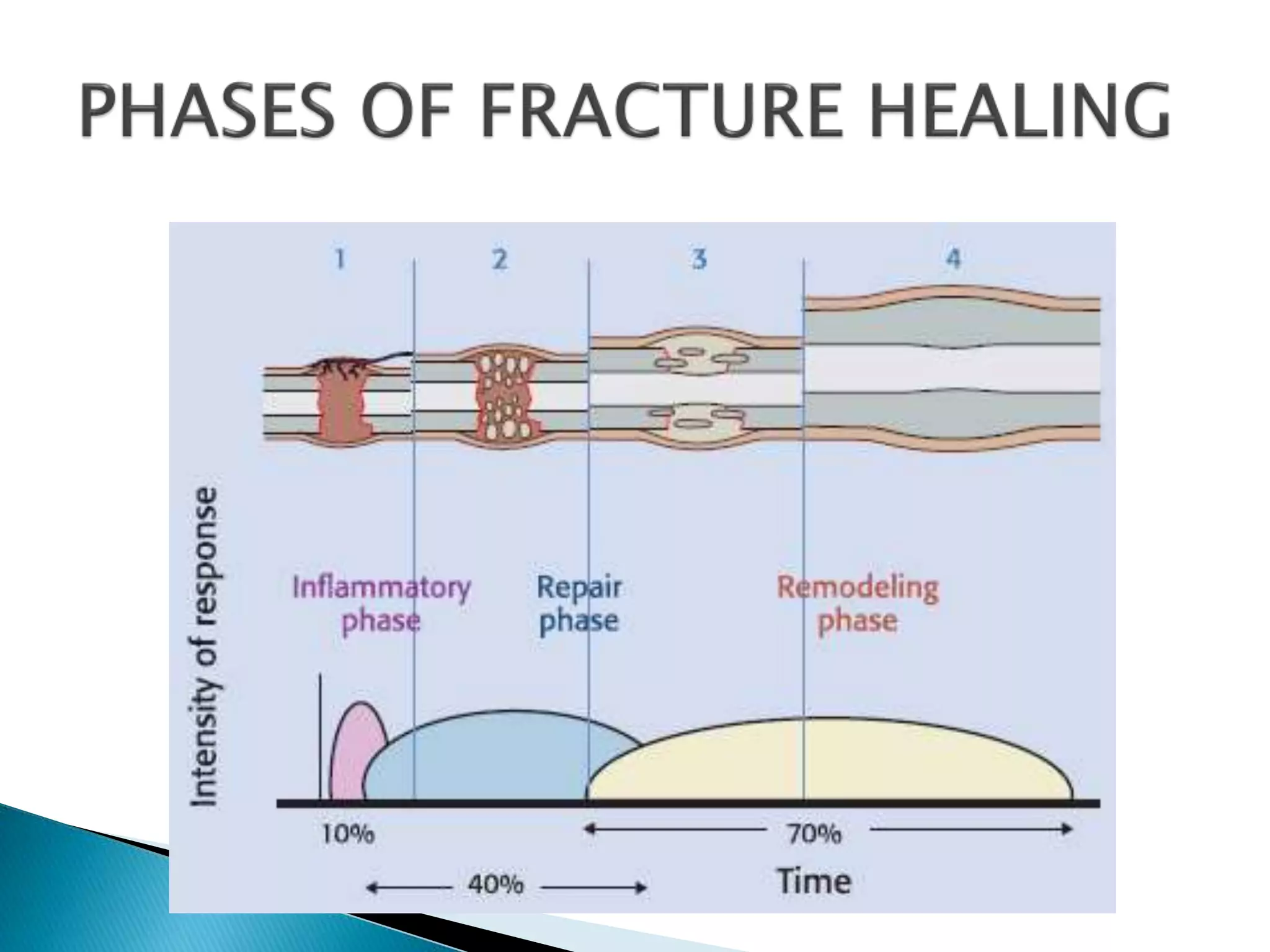 Fracture healing | PPTX