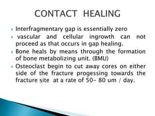 Fracture healing | PPTX