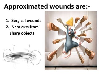Healing of an open wound | PPTX