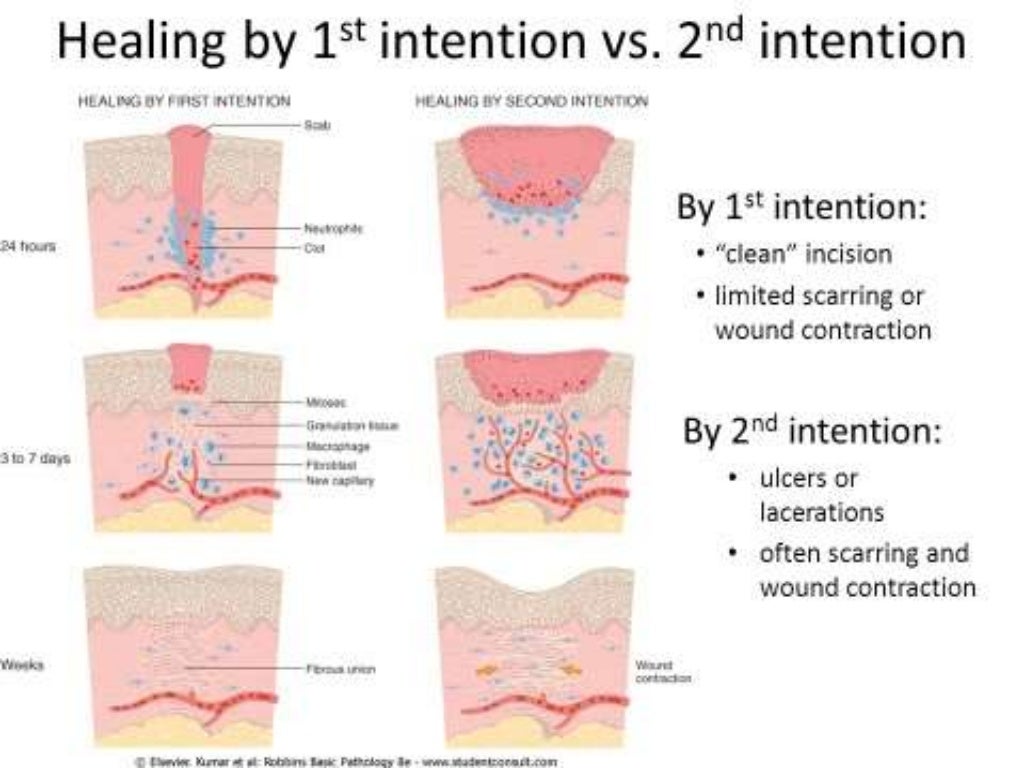 Healing of biopsy wound.