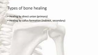 Healing of Bone - Dr. Shweta Yadav - Oral and Maxillofacial Surgery | PPTX
