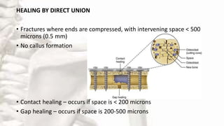 Healing of Bone - Dr. Shweta Yadav - Oral and Maxillofacial Surgery | PPTX