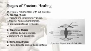 Healing of Bone - Dr. Shweta Yadav - Oral and Maxillofacial Surgery | PPTX
