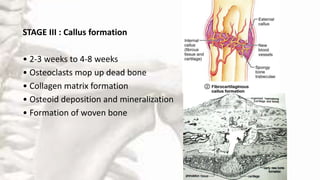 Healing of Bone - Dr. Shweta Yadav - Oral and Maxillofacial Surgery | PPTX