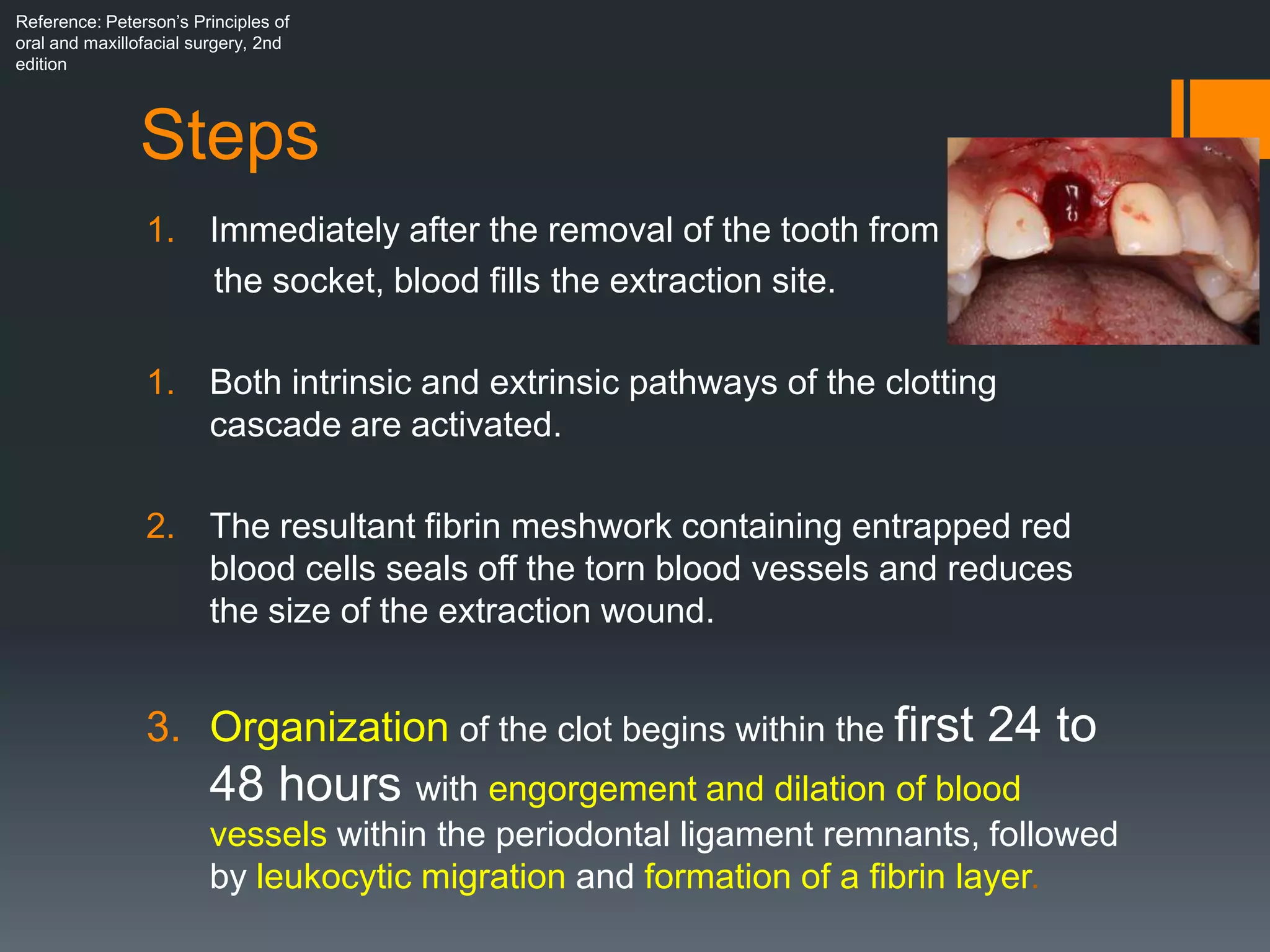 Healing of extraction wound | PPTX