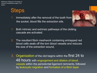 Healing of extraction wound | PPTX