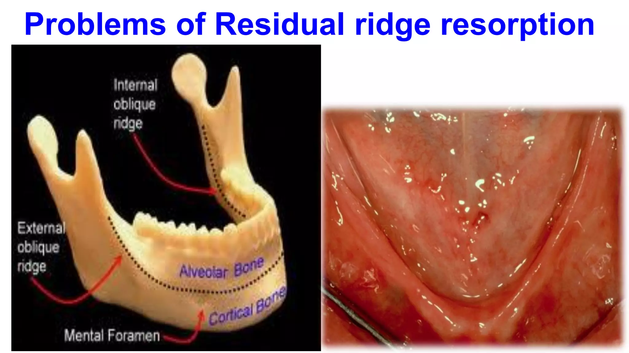 Healing Of Extraction Wound.pdf