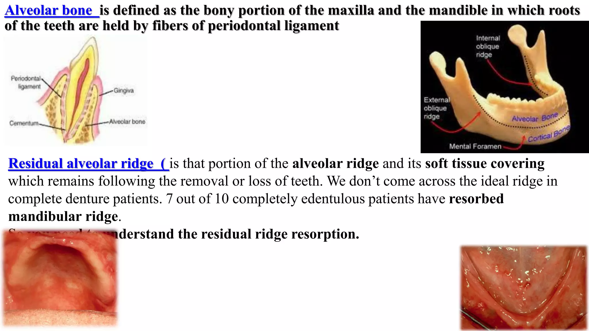 Healing Of Extraction Wound.pdf