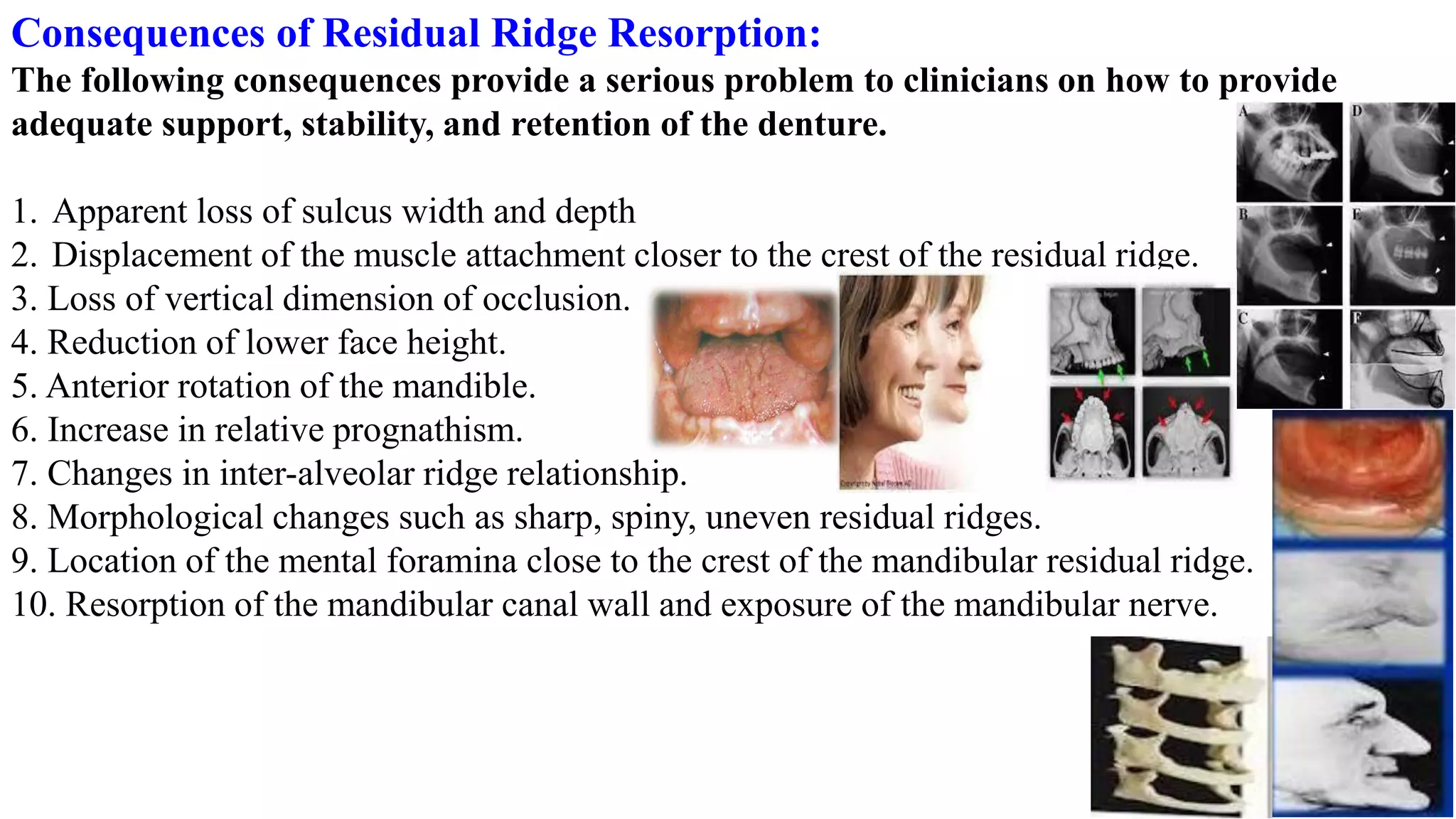Healing Of Extraction Wound.pdf