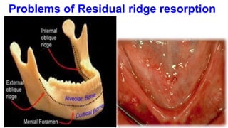 Healing Of Extraction Wound.pdf