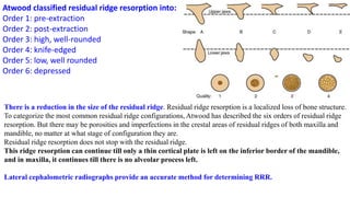 Healing Of Extraction Wound.pdf