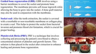Healing Of Extraction Wound.pdf
