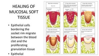 Healing of Fracture and Tooth Extraction Socket.pdf