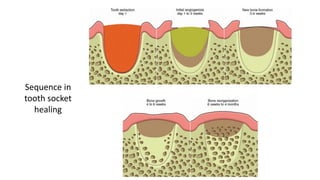 Healing of Fracture and Tooth Extraction Socket.pdf