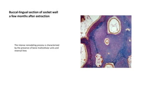 Healing of Fracture and Tooth Extraction Socket.pdf