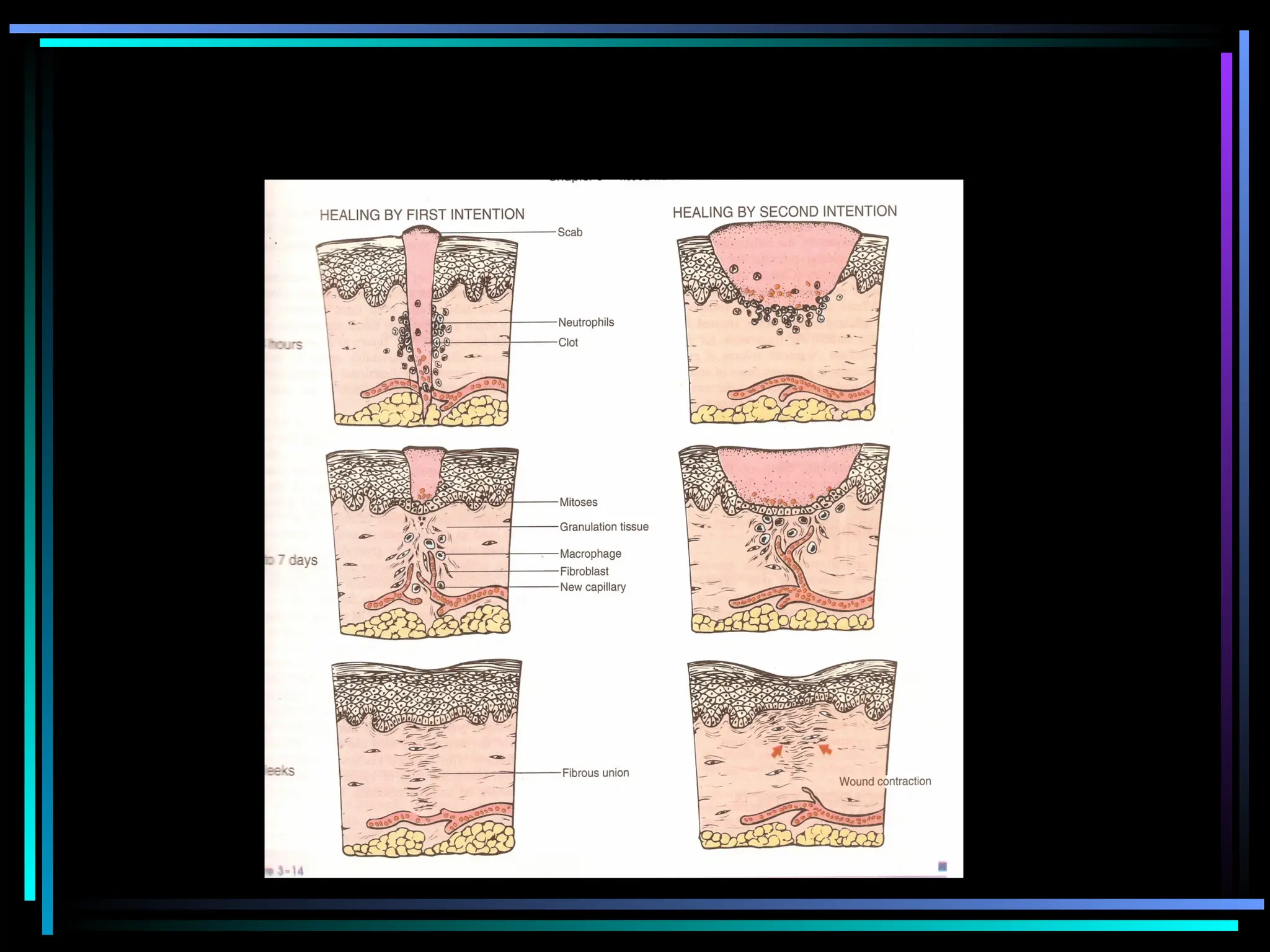 Healing of oral wounds modified in oral cavity | PPT