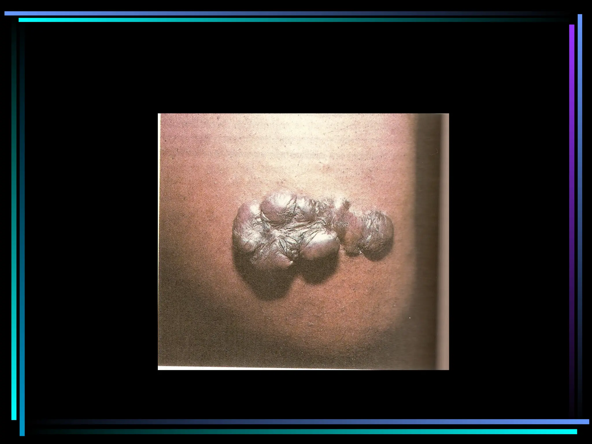 Healing of oral wounds modified in oral cavity | PPT