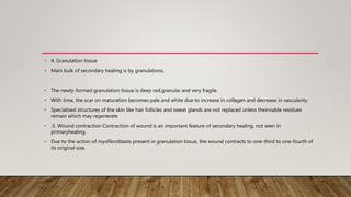 Healing of tissues | PPT