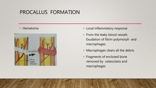 Healing of tissues | PPT