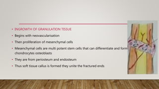Healing of tissues | PPT