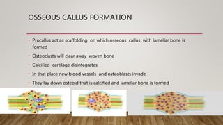 Healing of tissues | PPT