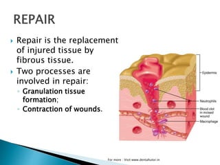Healing of wound | PPTX
