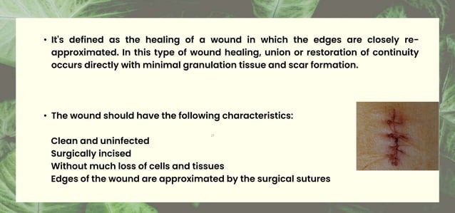 healing regeneration and repair mechanism.pptx