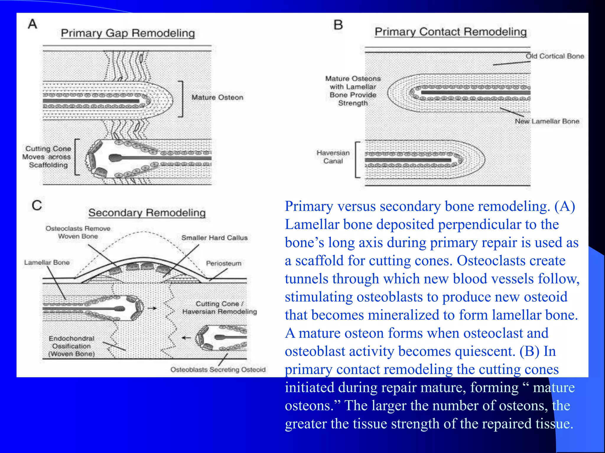 Pathology of Healing & repair | PPTX