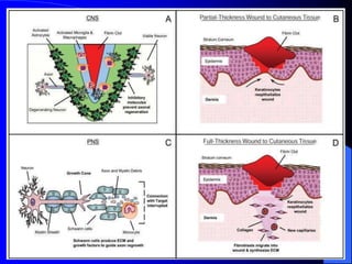 Pathology of Healing & repair | PPTX