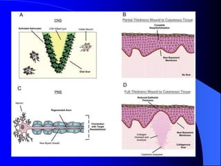 Pathology of Healing & repair | PPTX