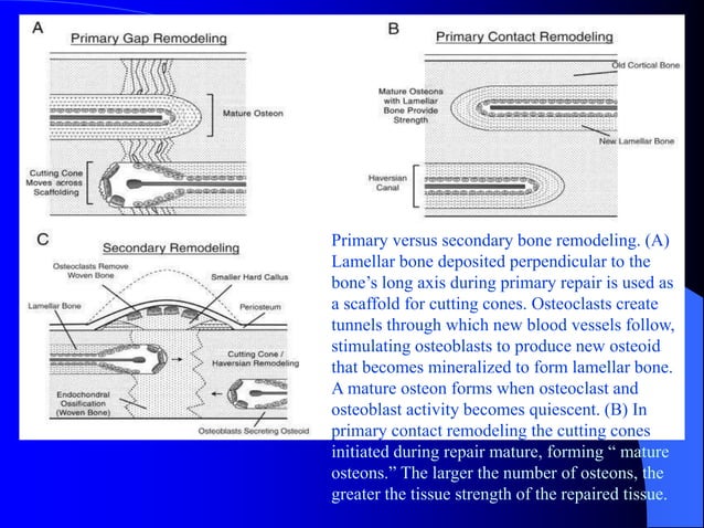 Pathology of Healing & repair | PPTX