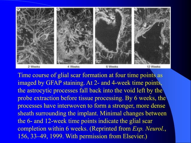 Pathology of Healing & repair | PPTX