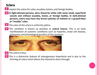 Healt assessment - Eyes | PPT