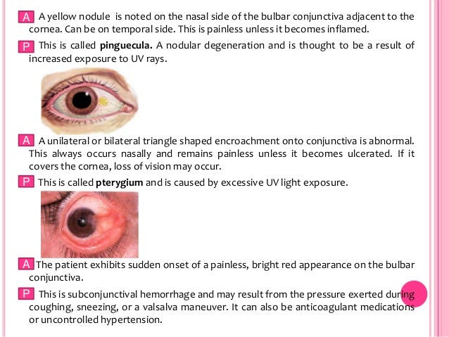 Healt assessment - Eyes