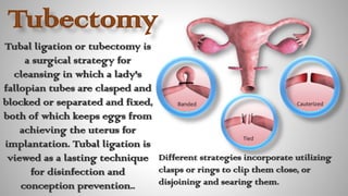 Reproductive health in human | PDF | Birth Control | Reproductive Health