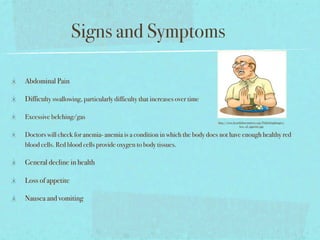 Health 10 Ppt[1]. Stomach Cancer | KEY
