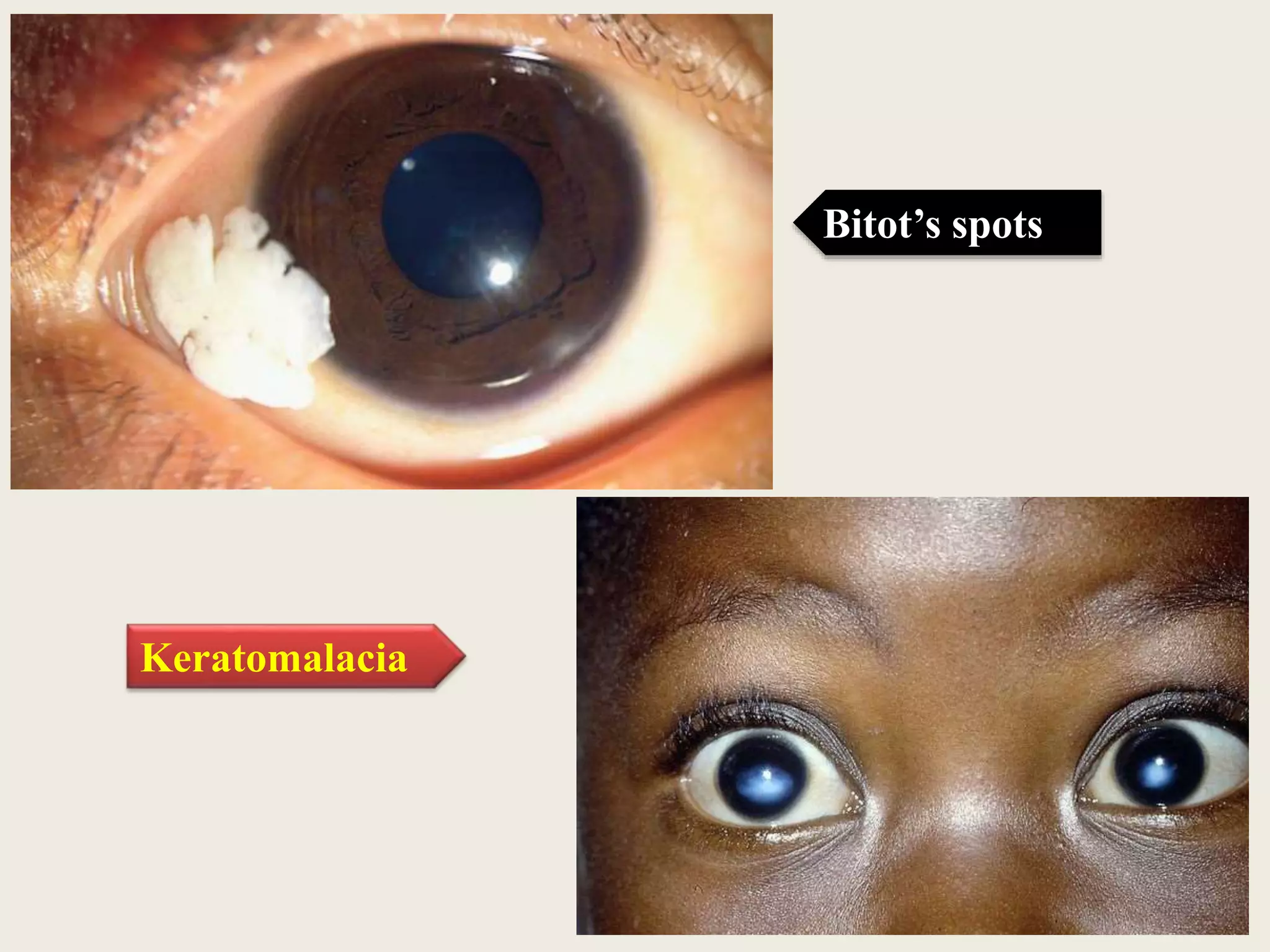 NUTRITION & HEALTH | PPTX