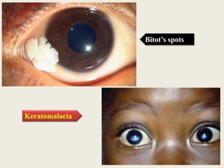 NUTRITION & HEALTH | PPTX