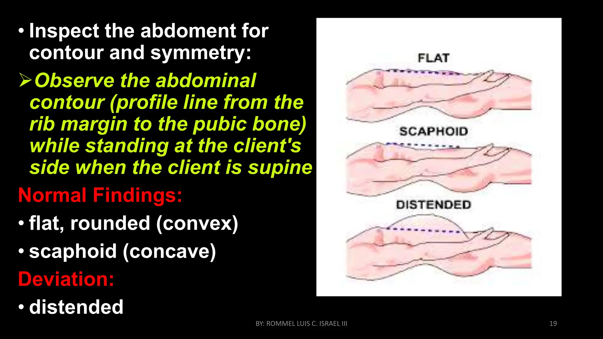 HEALTH ASSESSMENT IN NURSING - ABDOMEN (2) | PPTX | Digestive Disorders ...