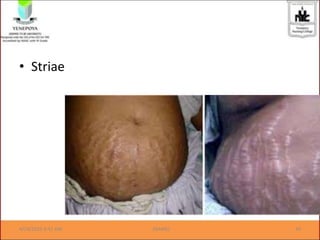 Health Assessment -Anterior chest , heart , abdomen examination.ppt