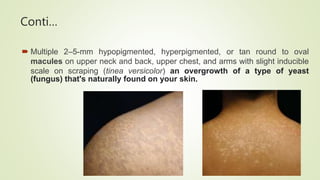 Health Assessment Findings on Skin Assessment.pptx