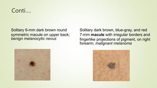 Health Assessment Findings on Skin Assessment.pptx